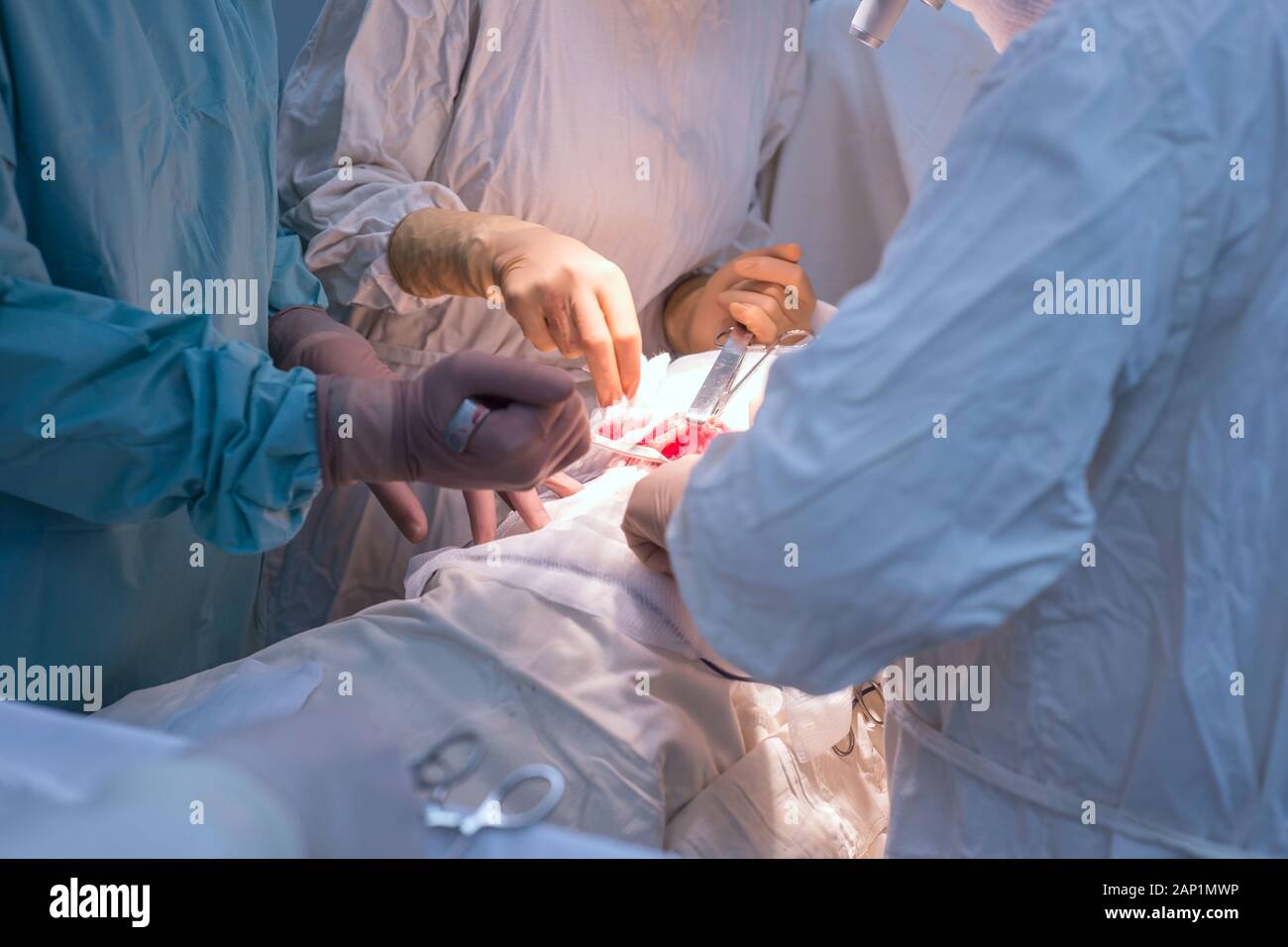 Doctors - children's surgeons, in a sterile operating room, perform a ...