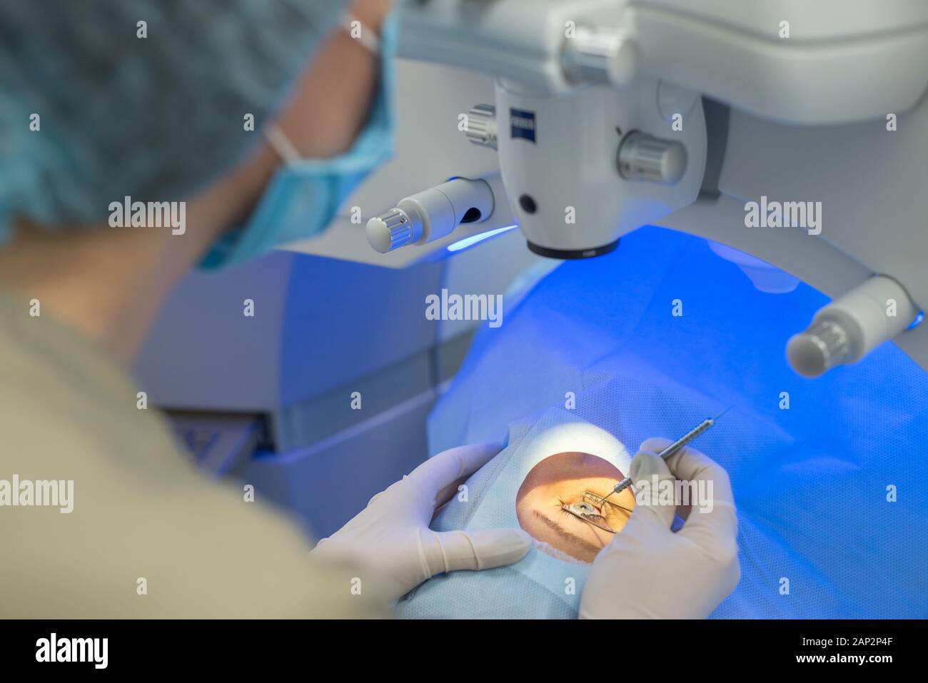 A close-up of the hands of an ophthalmologist surgeon looking through a ...