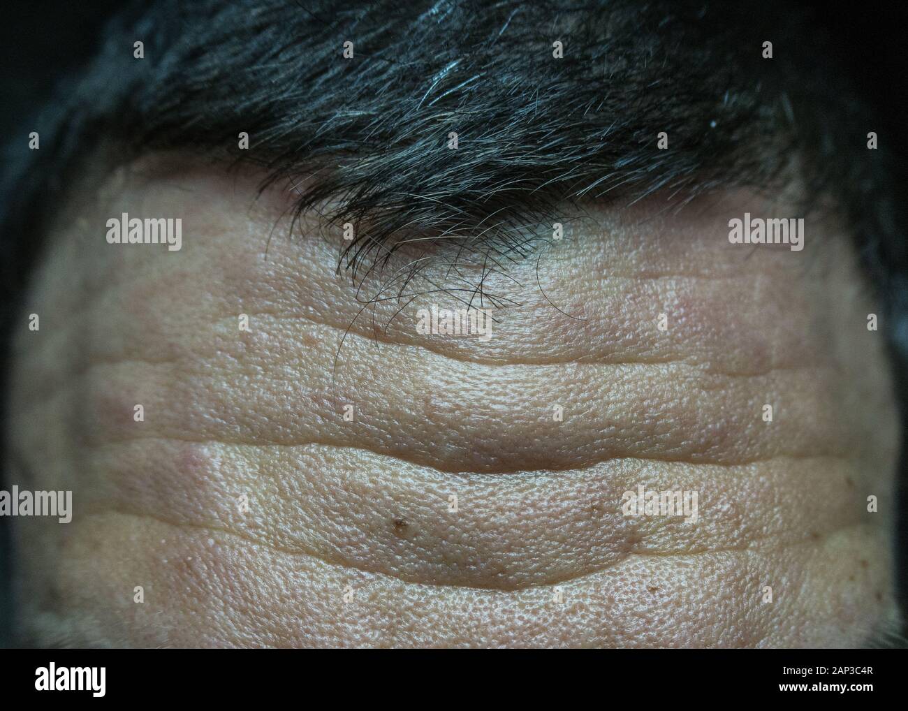 Forehead with wrinkles Stock Photo - Alamy