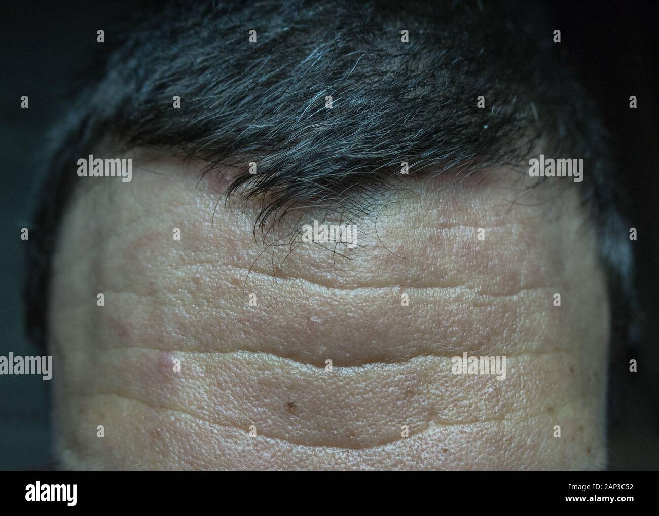 Forehead with wrinkles Stock Photo - Alamy