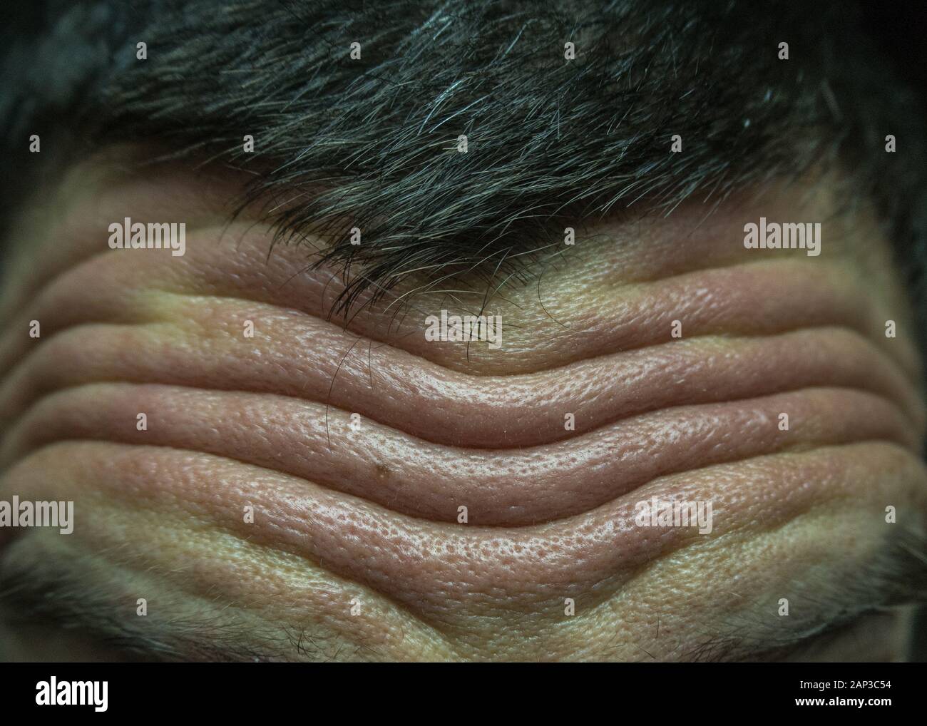 Forehead with large wrinkles Stock Photo - Alamy