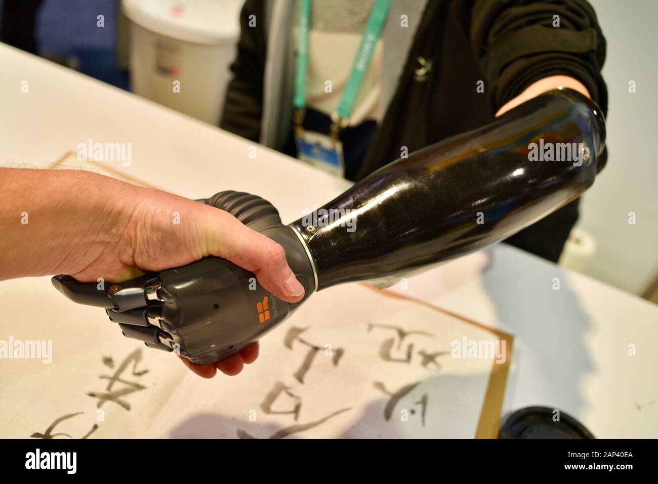 BrainCo prosthetic arm and hand using artificial intelligence and ...