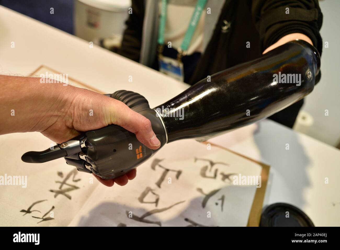 BrainCo prosthetic arm and hand using artificial intelligence and ...