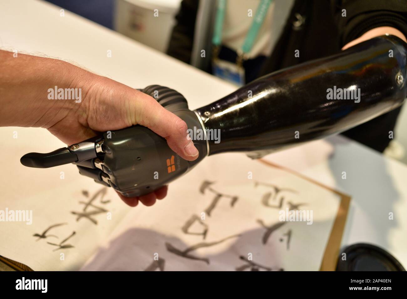 BrainCo prosthetic arm and hand using artificial intelligence and ...