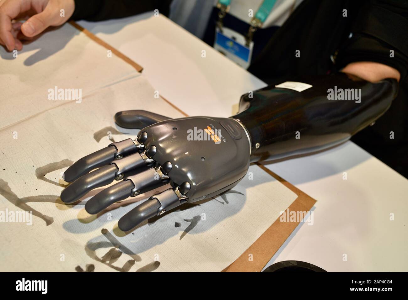 BrainCo prosthetic arm and hand using artificial intelligence and ...