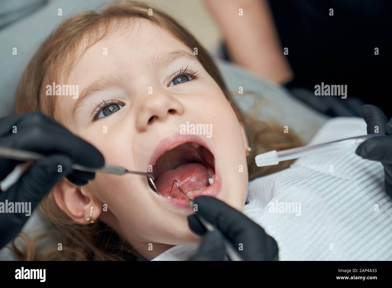 Portrait of pretty bold female child sitting in dental chair with open ...