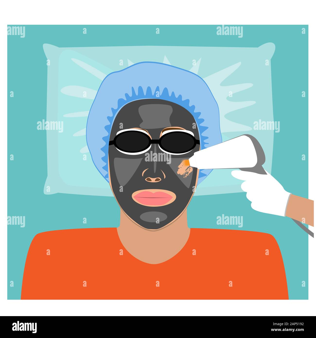Procedure of carbon peeling, vector illustration. Laser rejuvenation ...