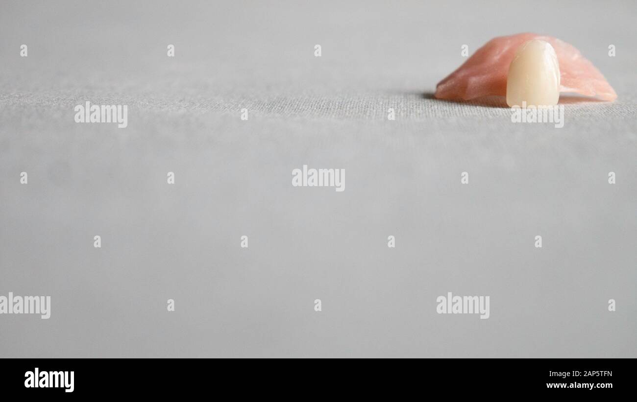 One false plastic tooth. Dental prosthetics on a background. Dentures ...