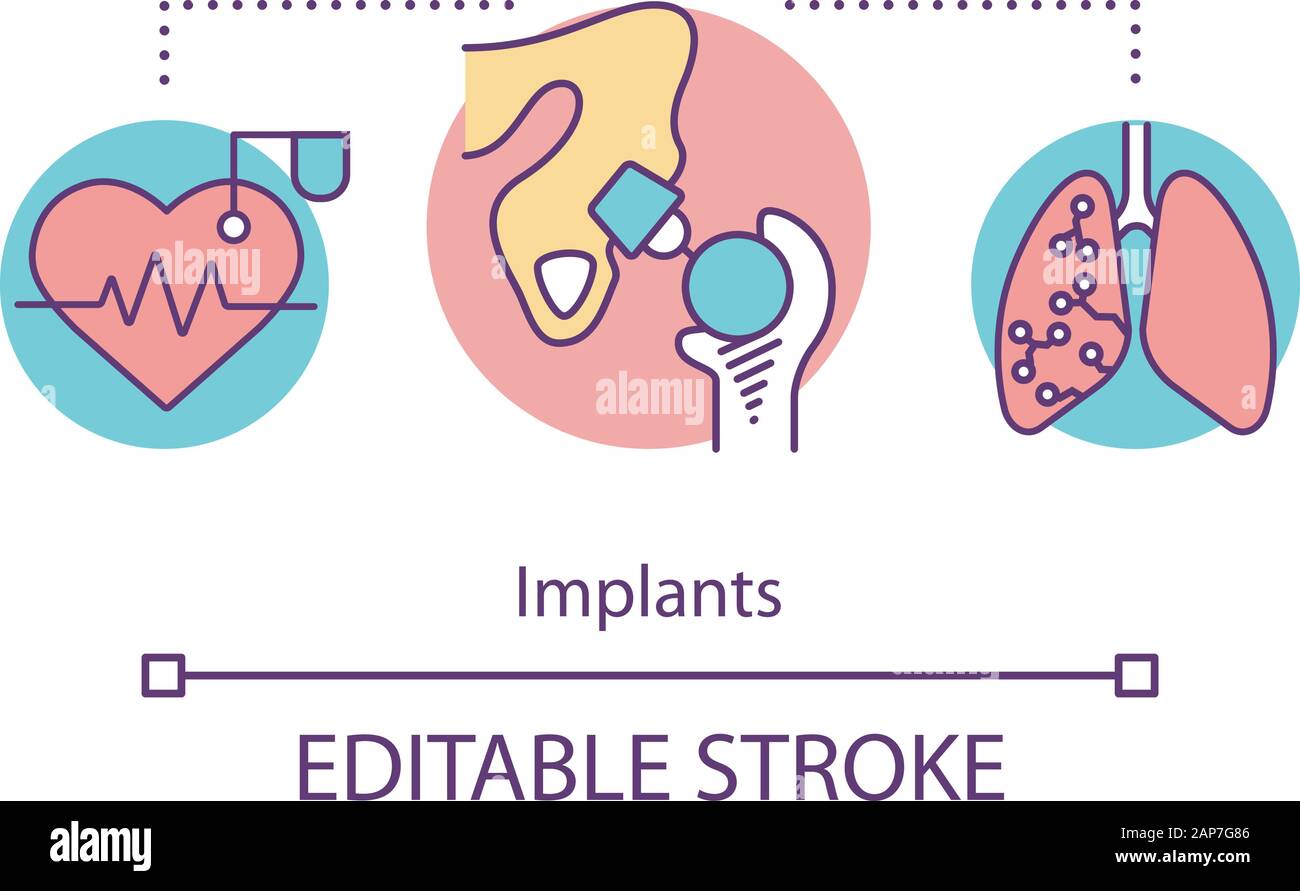 Implants concept icon. Medical prosthetic device. Artificial joint ...