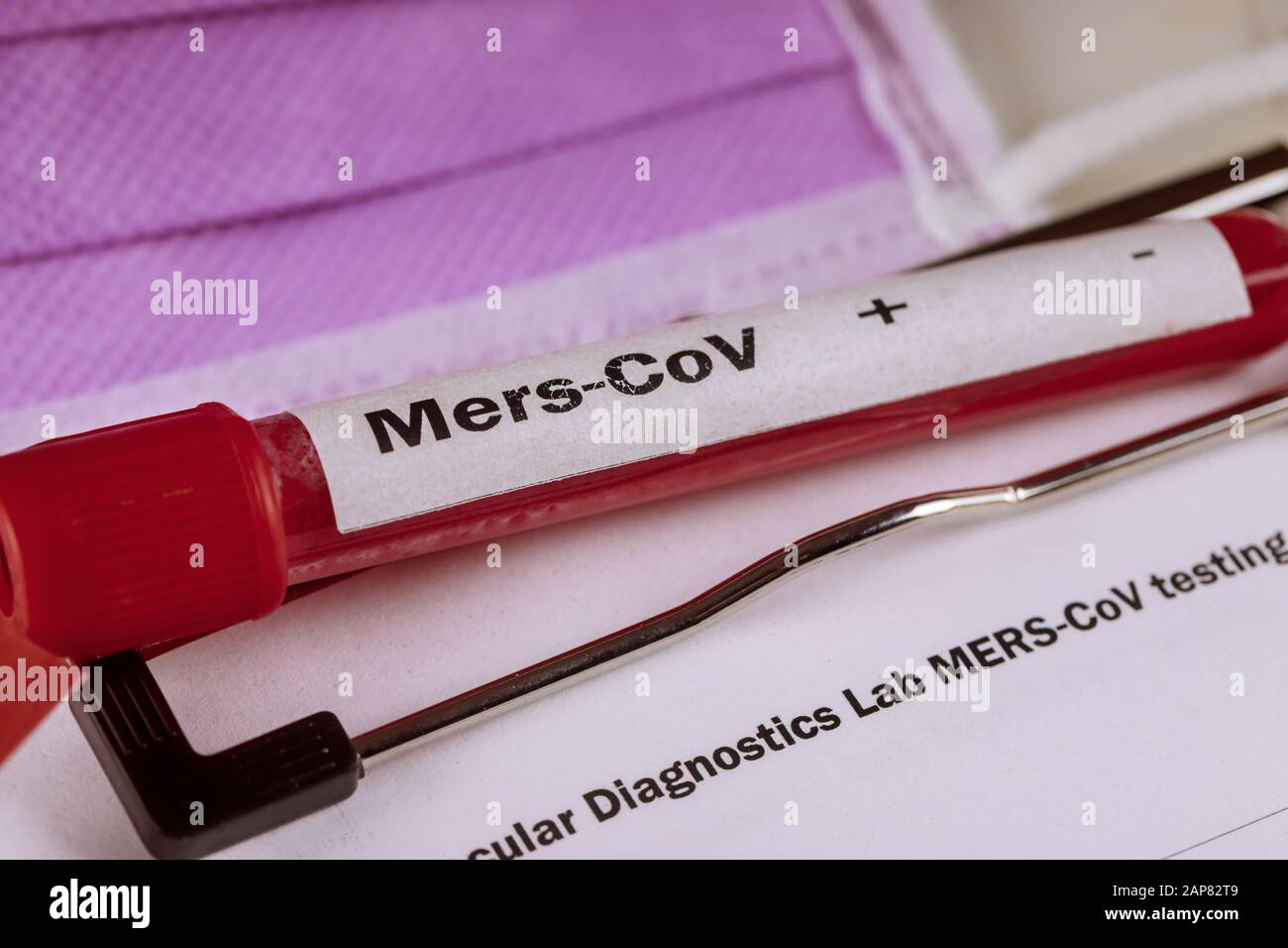 Test tube containing MERS-CoV, medical reseacher in a laboratory test ...