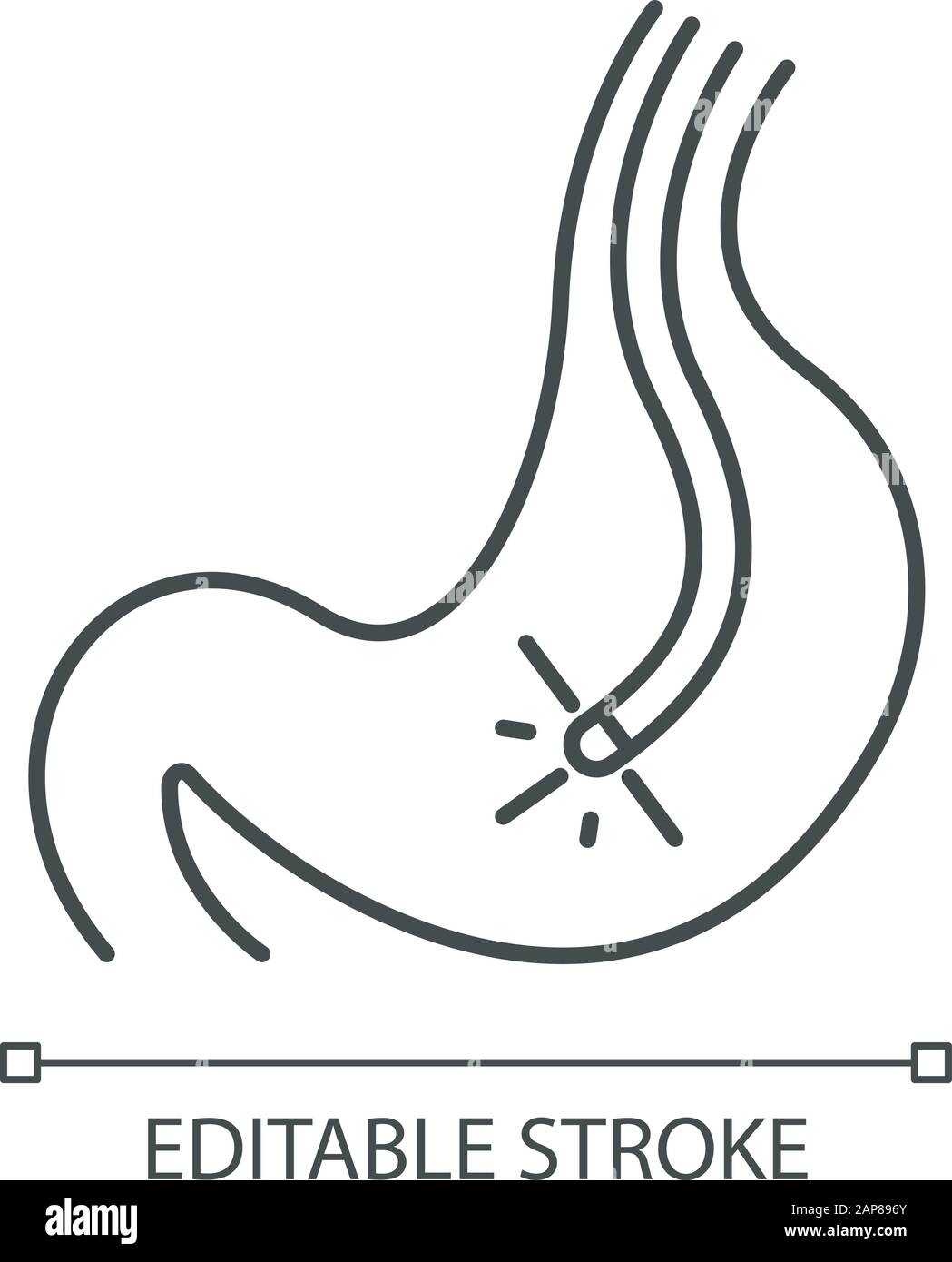 Gastroscopy illustration Black and White Stock Photos & Images - Alamy