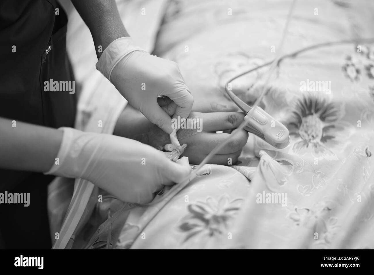 Intravenous administration of a sedative through a catheter mounted on ...