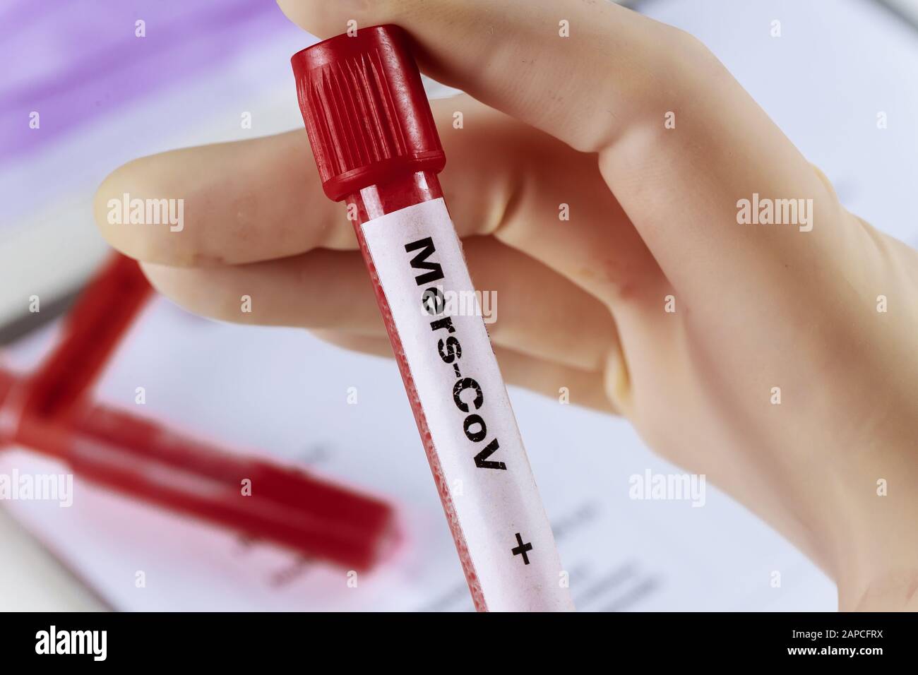 MERS-CoV blood test medical equipment one of several test tubes with ...