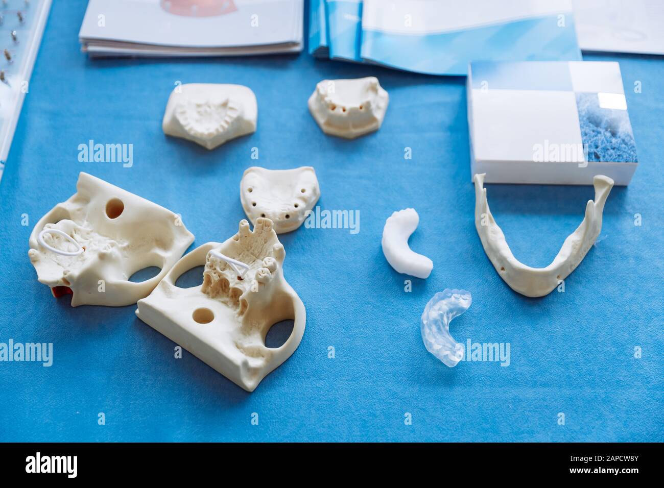 A plastic model of the jaw for prosthetics lies on the table. On a blue ...