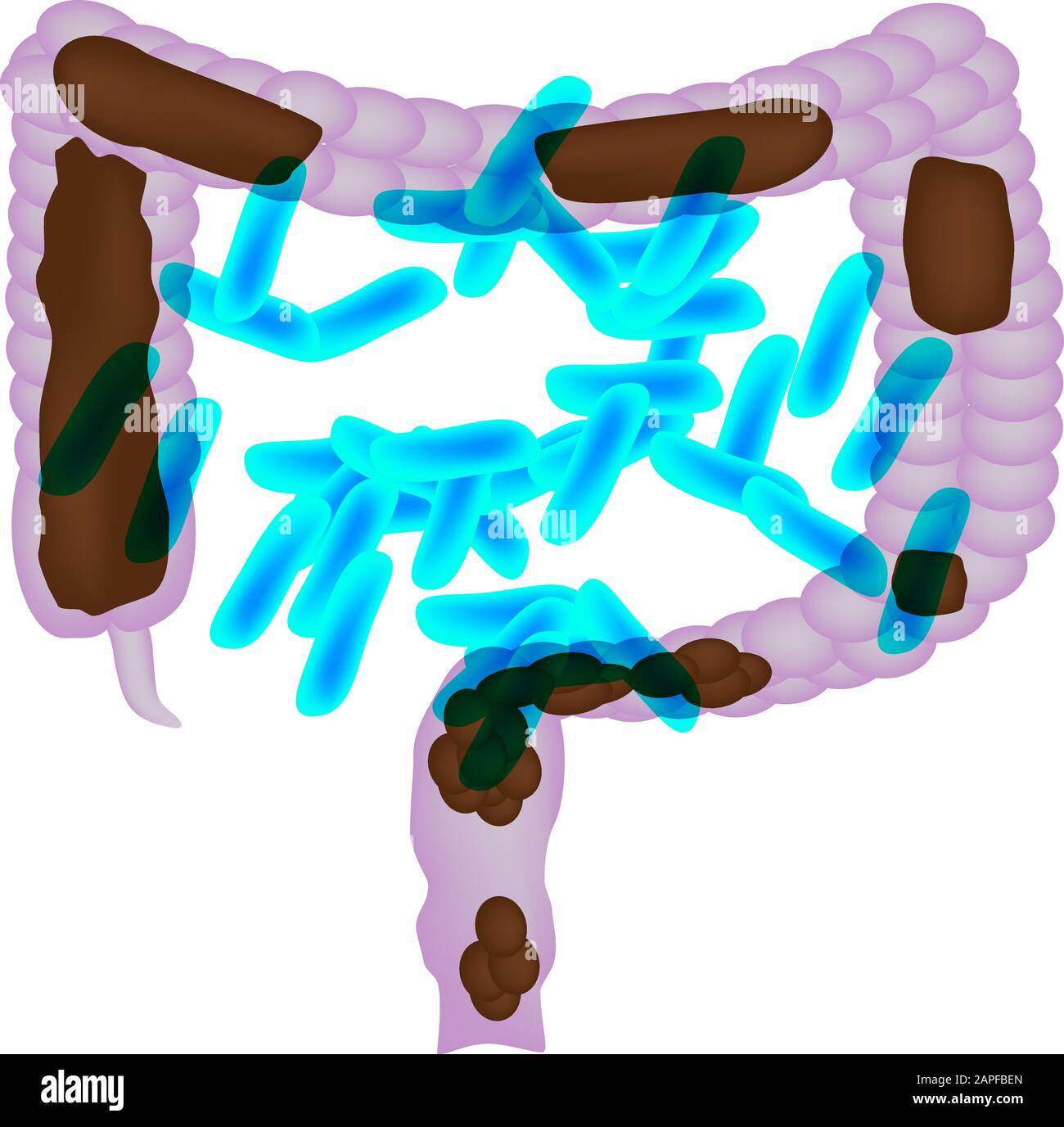 Treatment of constipation with probiotics. Lactobacillus. Feces in ...