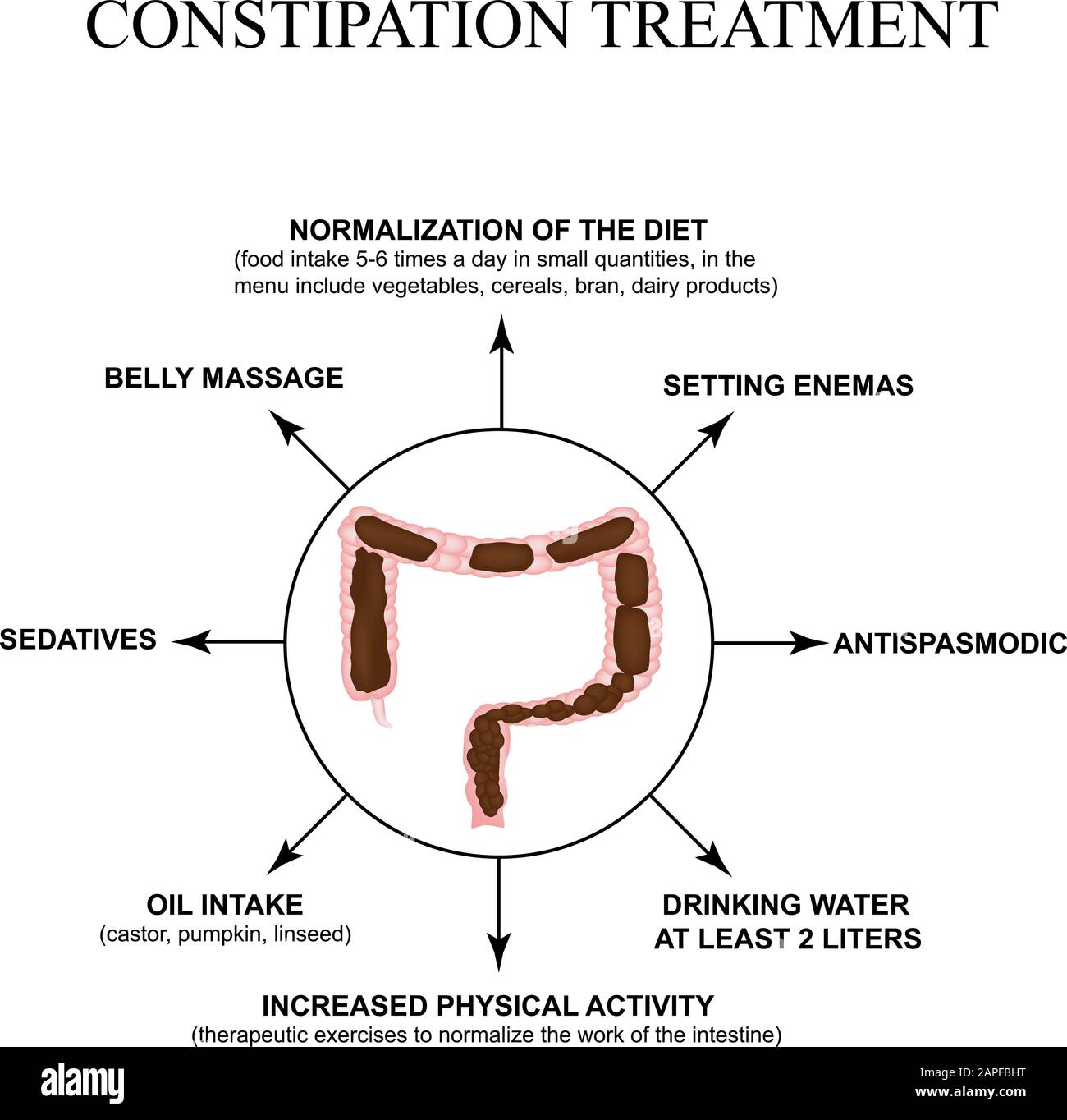 Treatment of constipation. Infographics. Vector illustration on ...