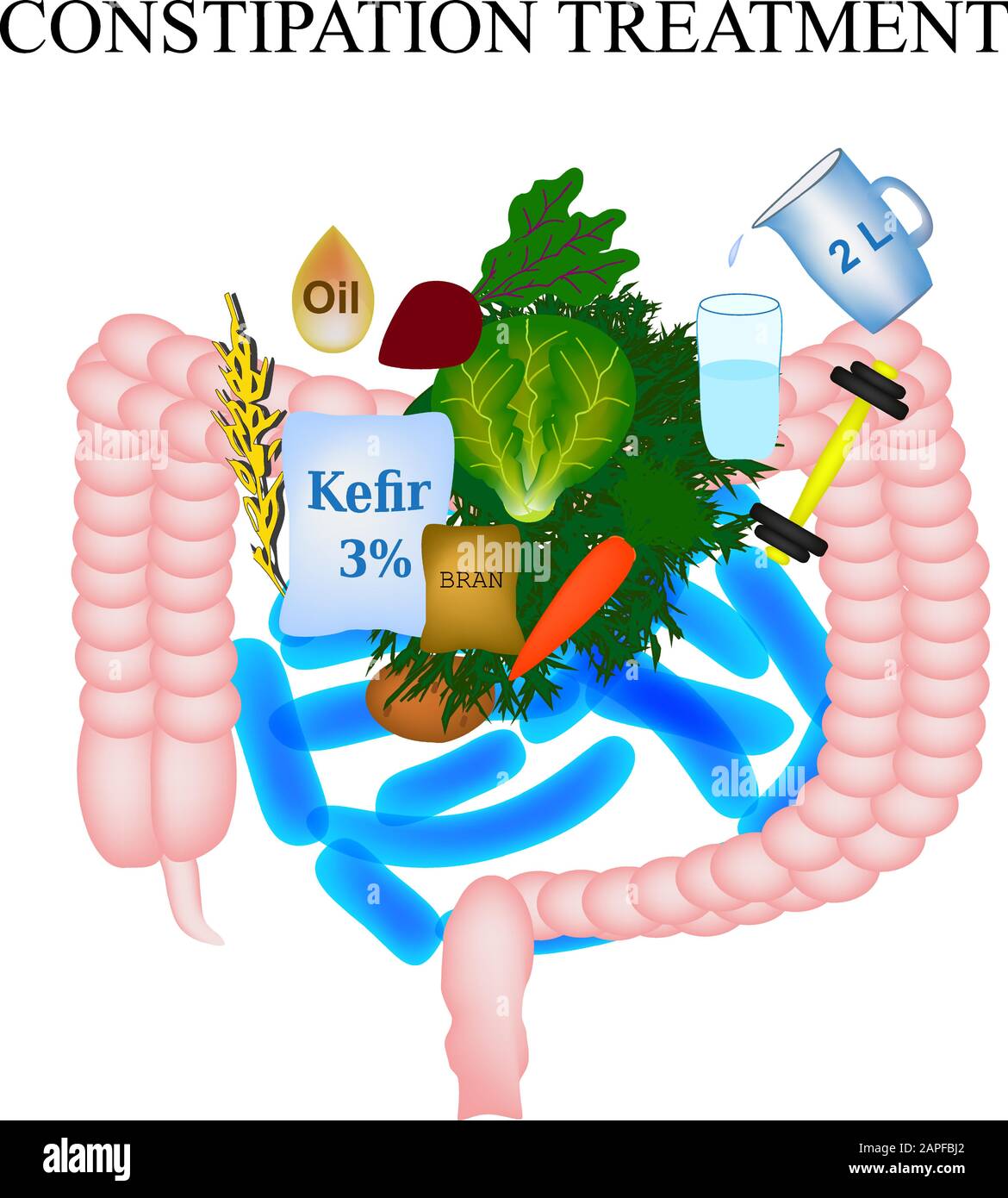 Treatment of constipation. Infographics. Vector illustration on ...