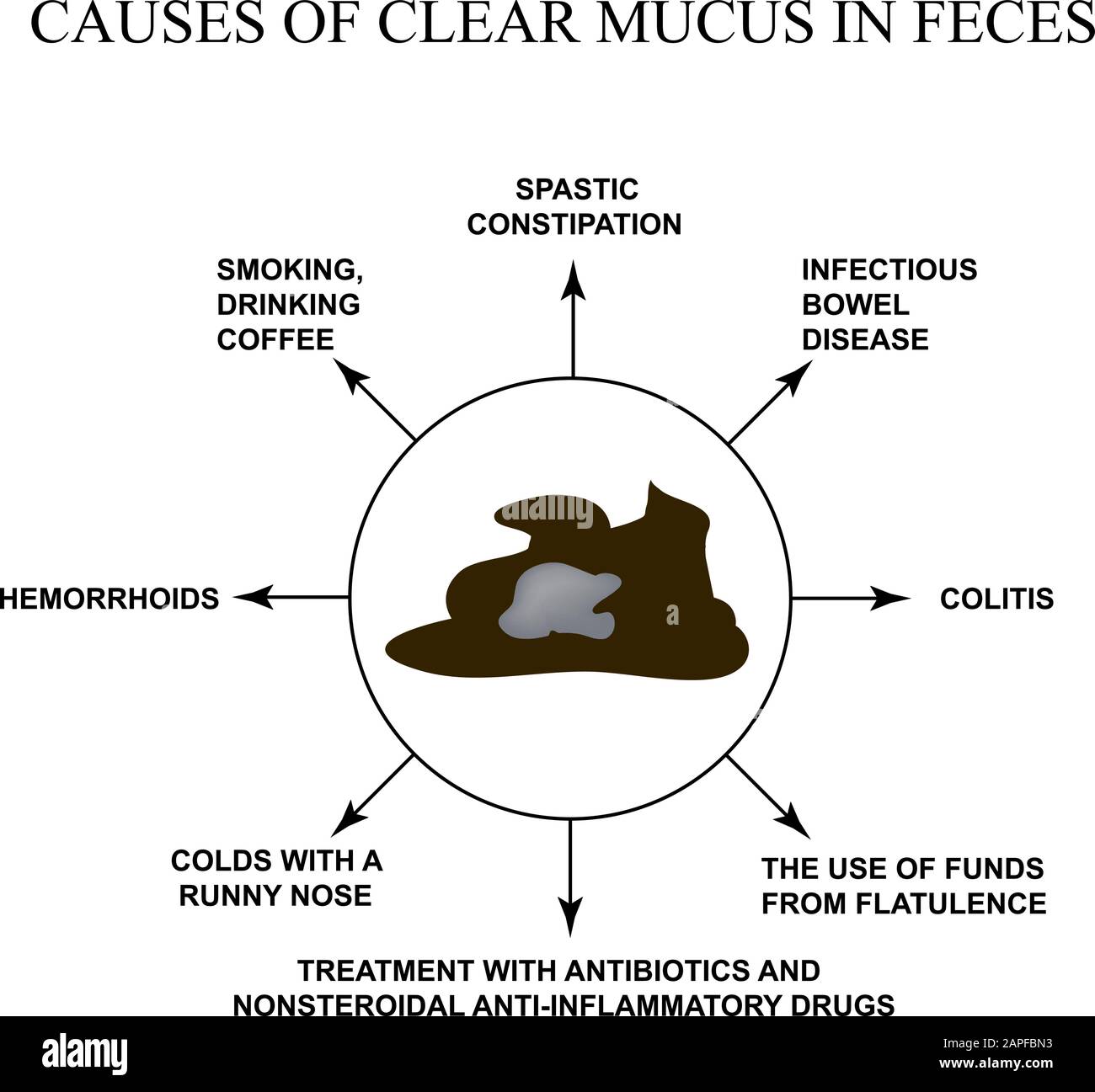 Causes of clear mucus in the feces. Diseases of the gastrointestinal ...