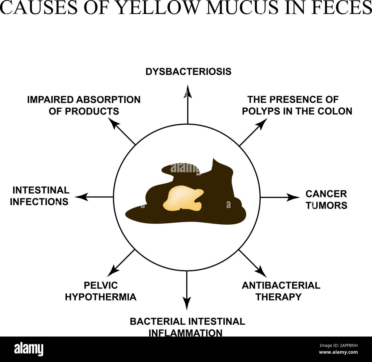 Causes of yellow mucus in feces. Diseases of the gastrointestinal tract ...