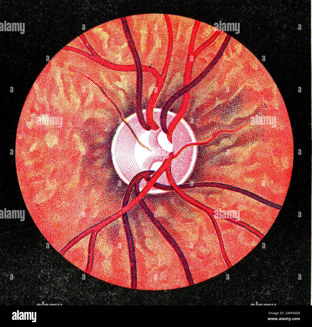 Fundus Eye Stock Photos & Fundus Eye Stock Images - Alamy