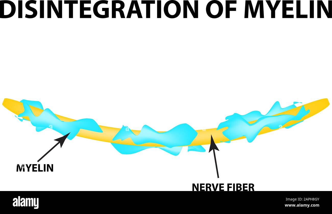 Myelin sheath hi-res stock photography and images - Alamy