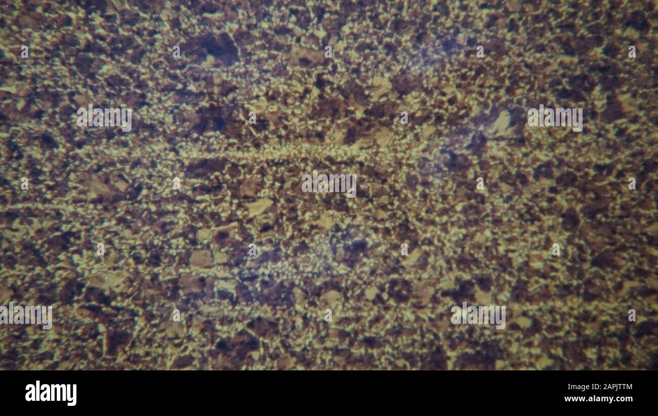 Micrograph metal hi-res stock photography and images - Alamy