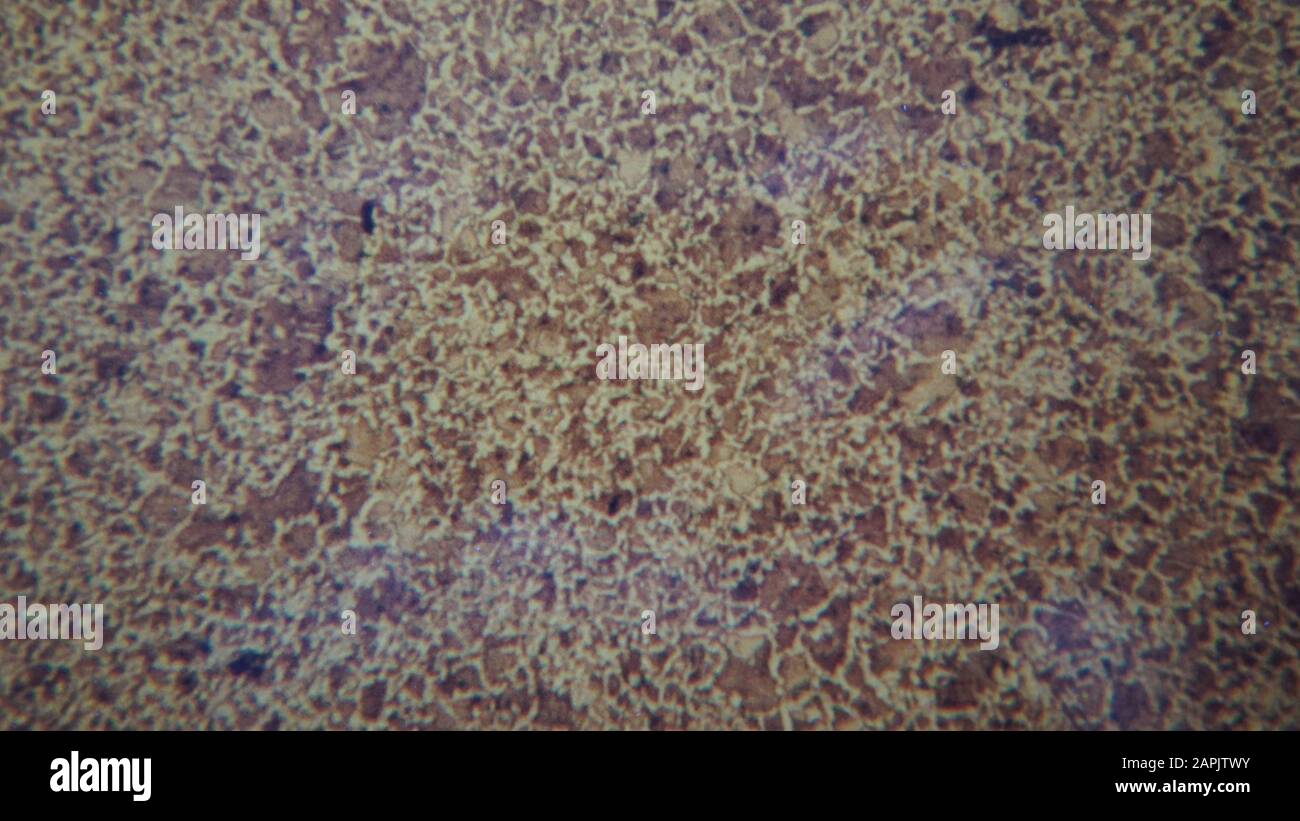 Micrograph metal hi-res stock photography and images - Alamy
