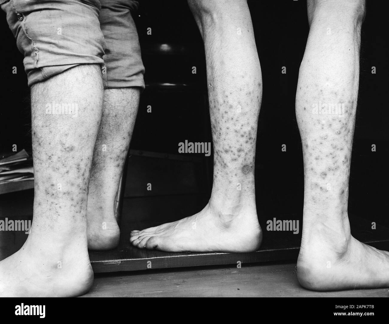 Beet diseases hi-res stock photography and images - Alamy