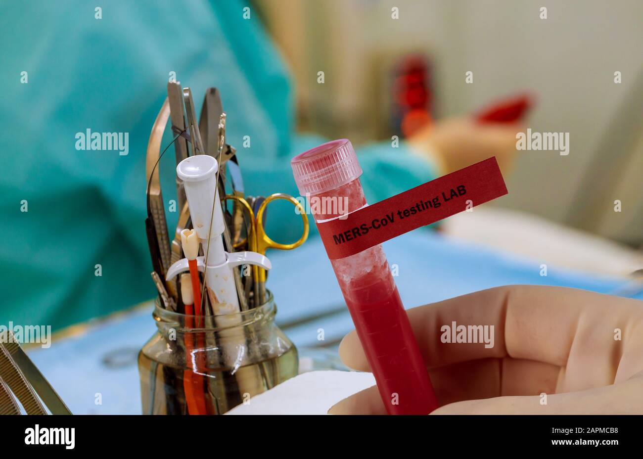 Middle East Respiratory Syndrome Coronavirus blood MERS-CoV test adding ...