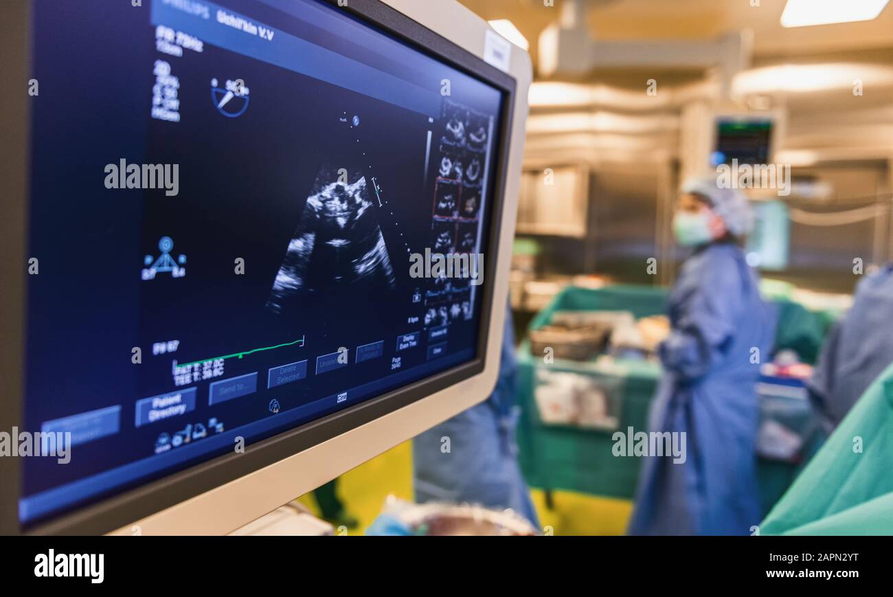 Heart ultrasound monitor hi-res stock photography and images - Alamy