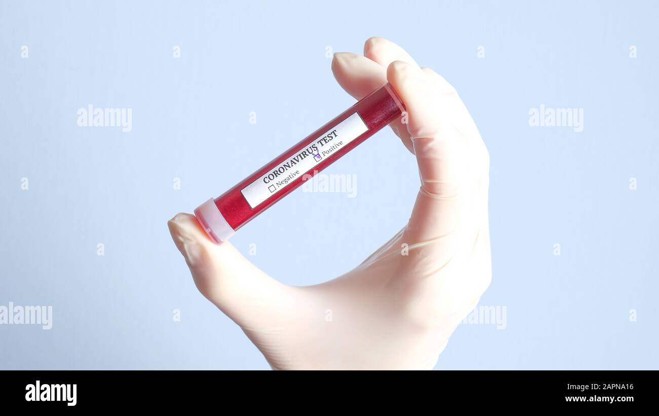 Coronavirus blood test concept. Doctor hand in white medical glove ...