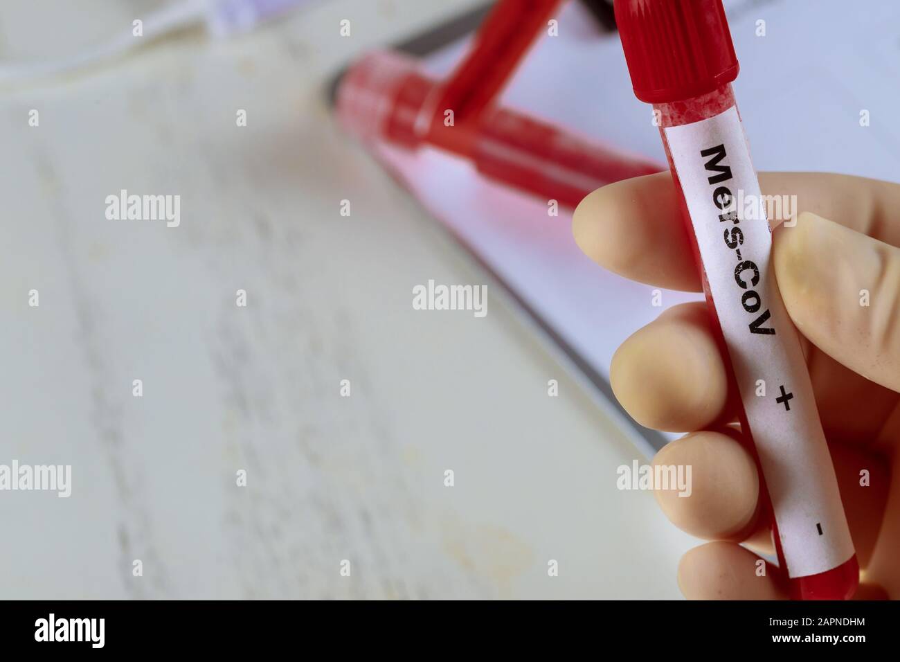 Middle East Respiratory Syndrome Coronavirus blood MERS-CoV test adding ...