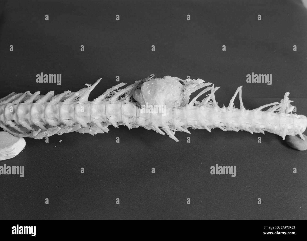 Lordosis High Resolution Stock Photography and Images - Alamy
