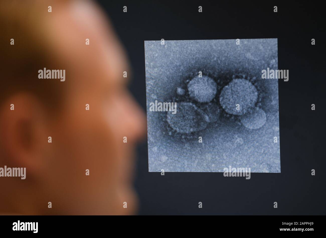 Electron microscope image hi-res stock photography and images - Alamy