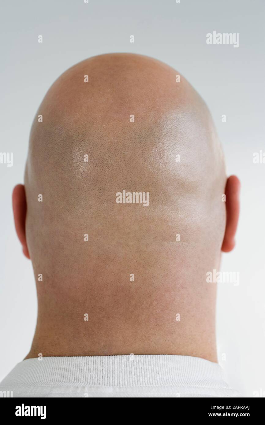 Rear view of a bald headed man Stock Photo - Alamy