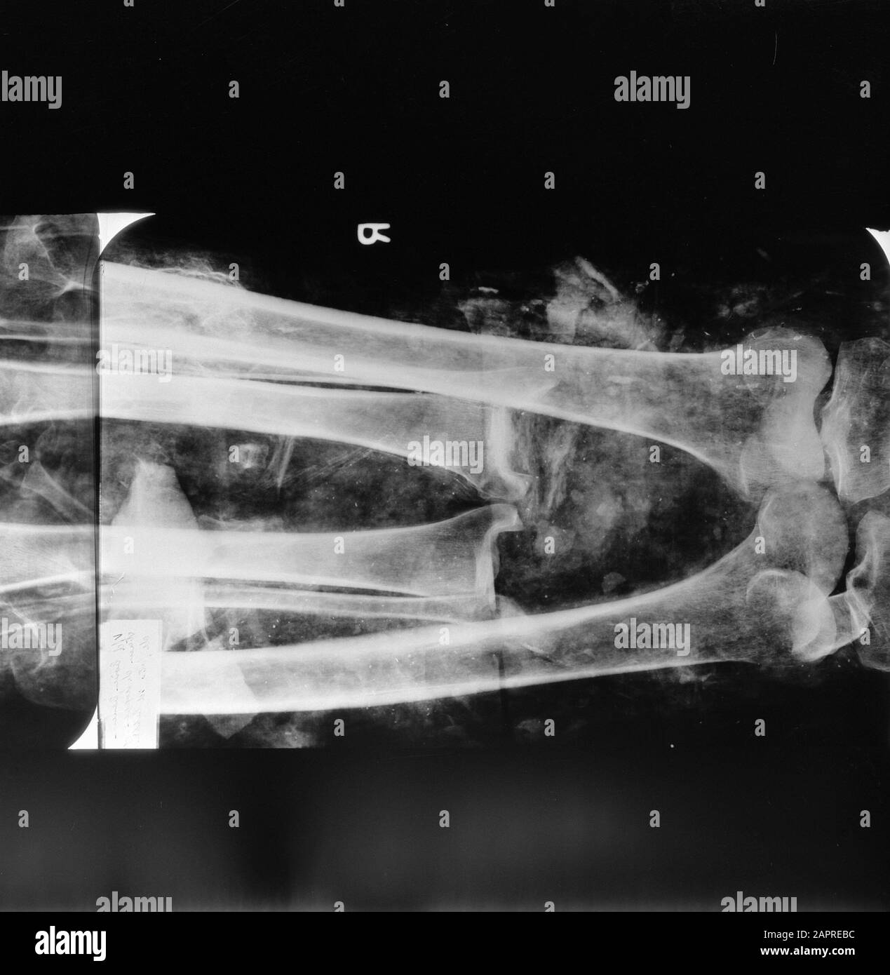 Mummy leg Black and White Stock Photos & Images - Alamy