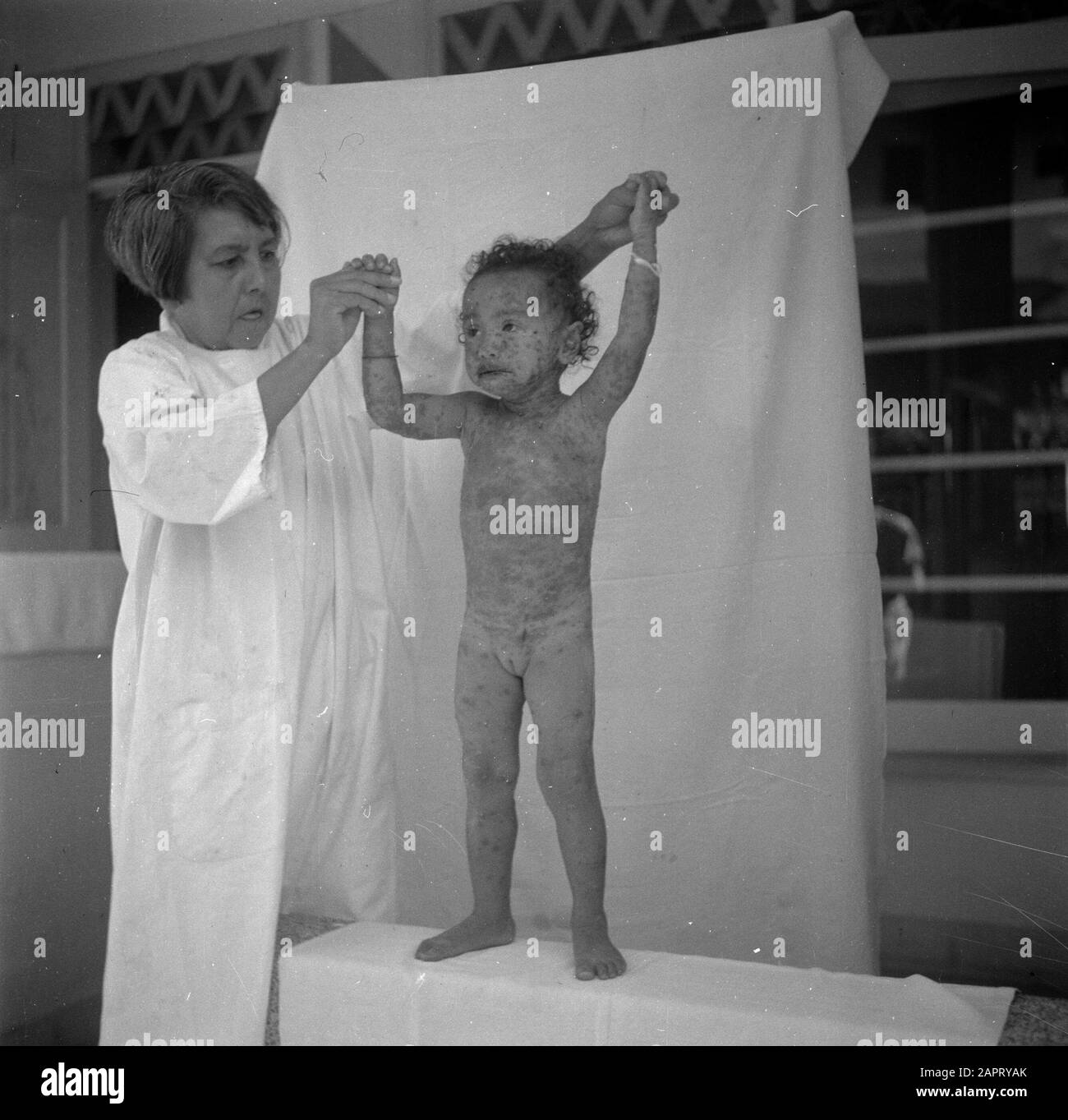 War volunteers in Malacca and Indonesia A girl with a rash is examined ...