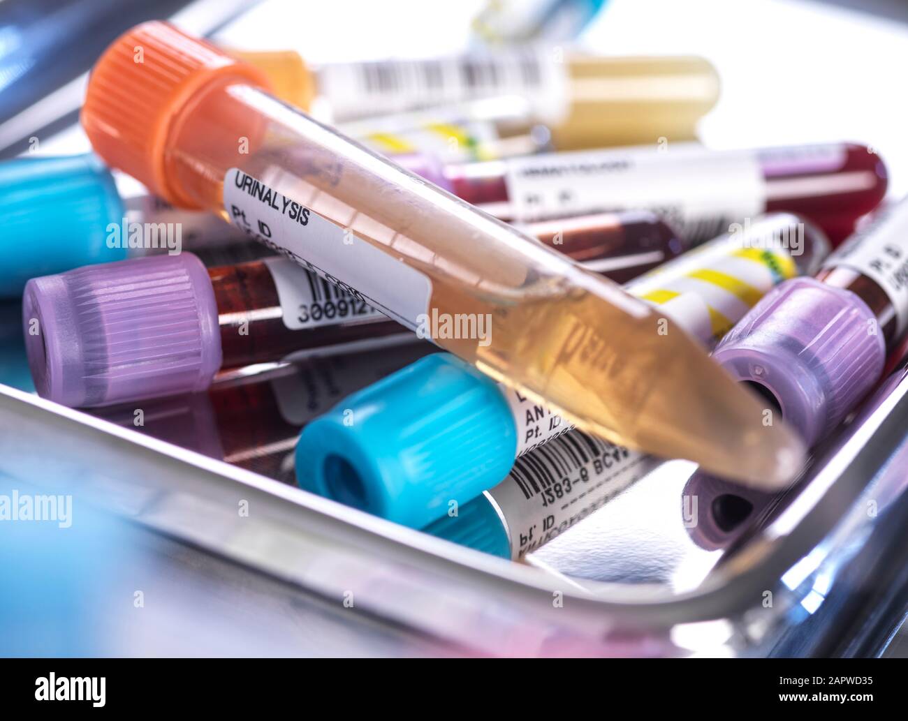 Urine test sample Stock Photo - Alamy