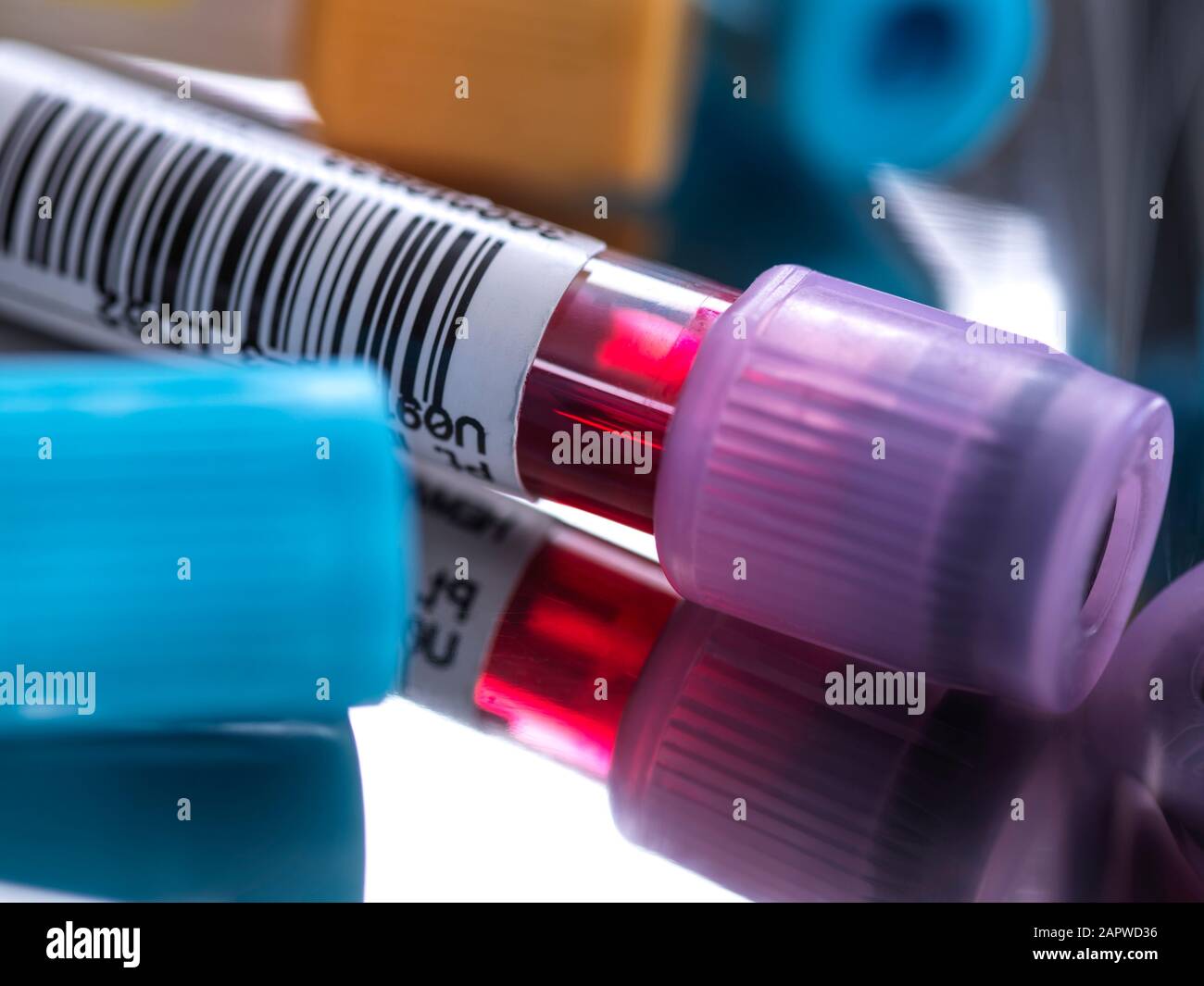 Samples for medical screening Stock Photo - Alamy