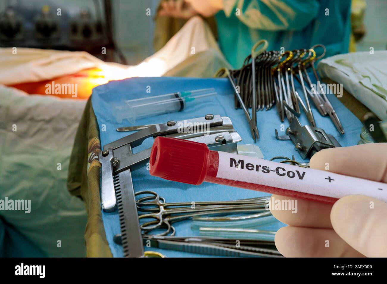 Surgical in operating room medical equipment Blood sample with MERS-CoV ...
