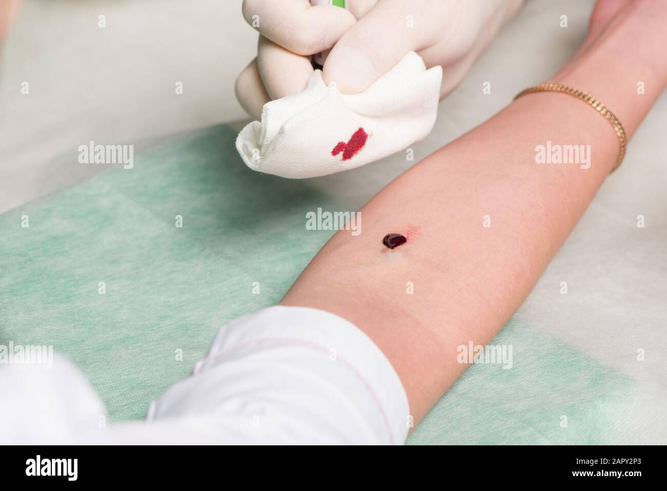 Male hands in medical gloves process site of vein puncture in area of ...
