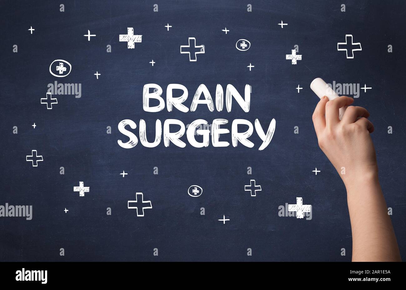 Hand drawing BRAIN SURGERY inscription with white chalk on blackboard ...