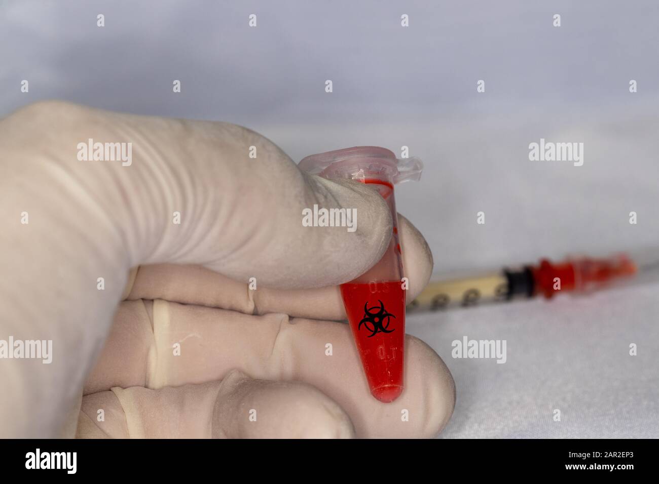 Coronavirus blood sample in laboratory vial labeled with biohazard sign ...