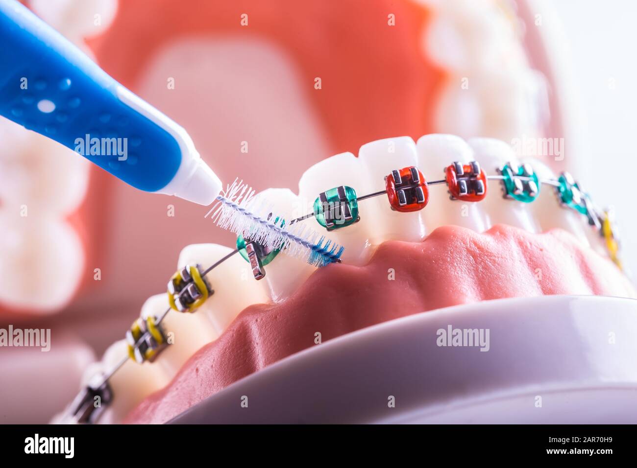 Tooth model from dental braces with inter dental teeth cleaning brush ...