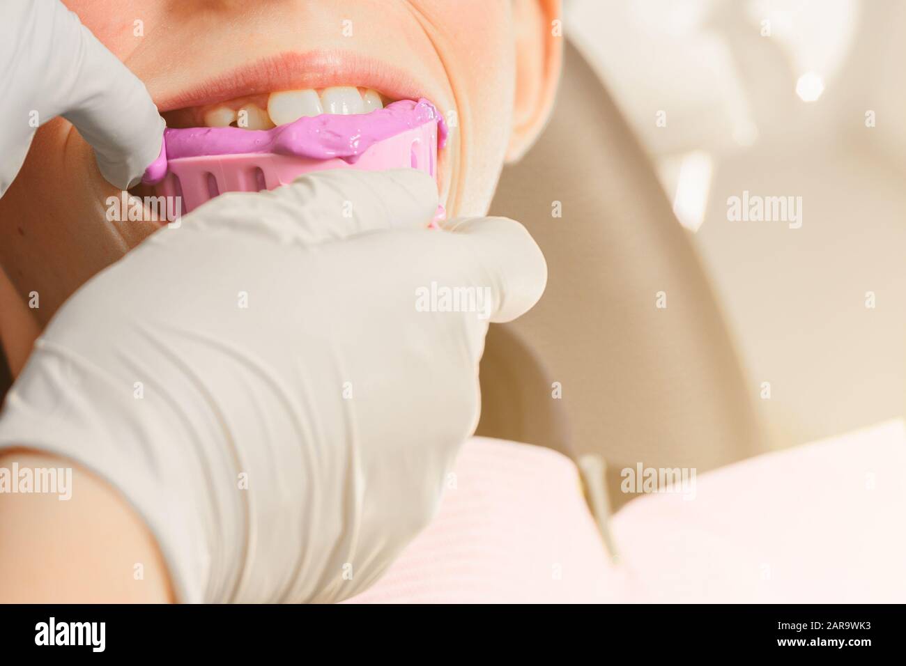 Registration of impressions and bites in a young teenager. Functional ...