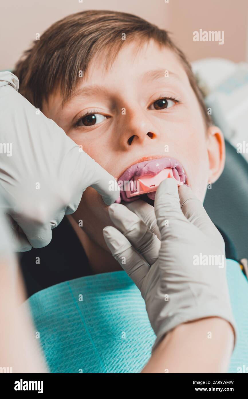 Registration of impressions and bites in a young teenager. Functional ...