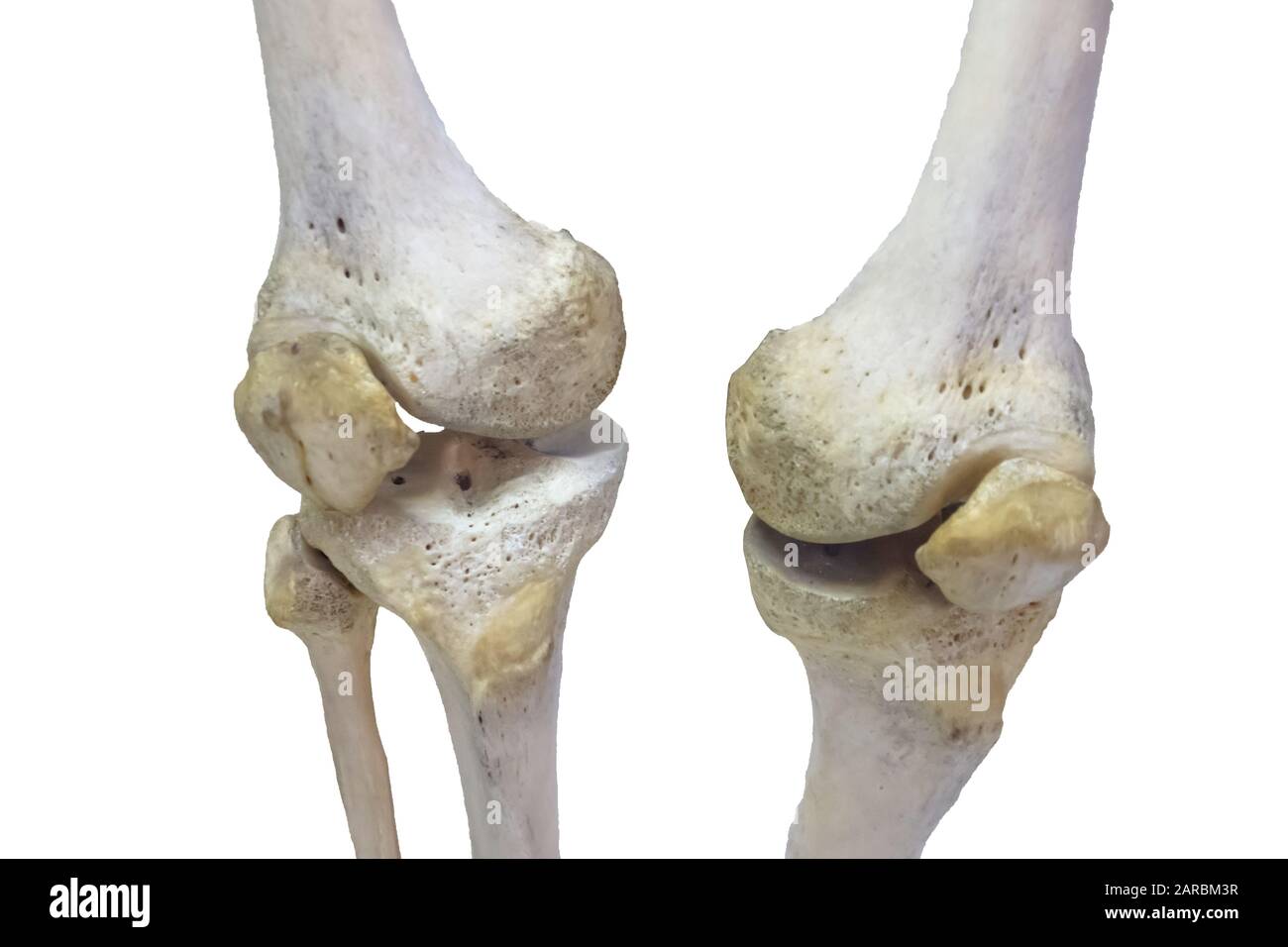 Pair of legs and knee joint of human bone, close up view isolated on ...
