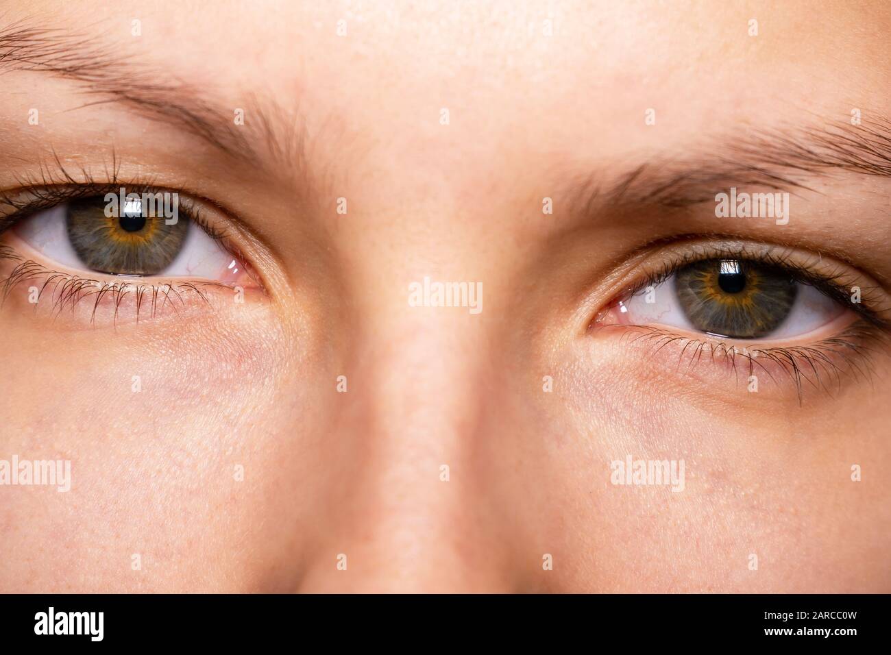 2 Different Colored Eyes Girl