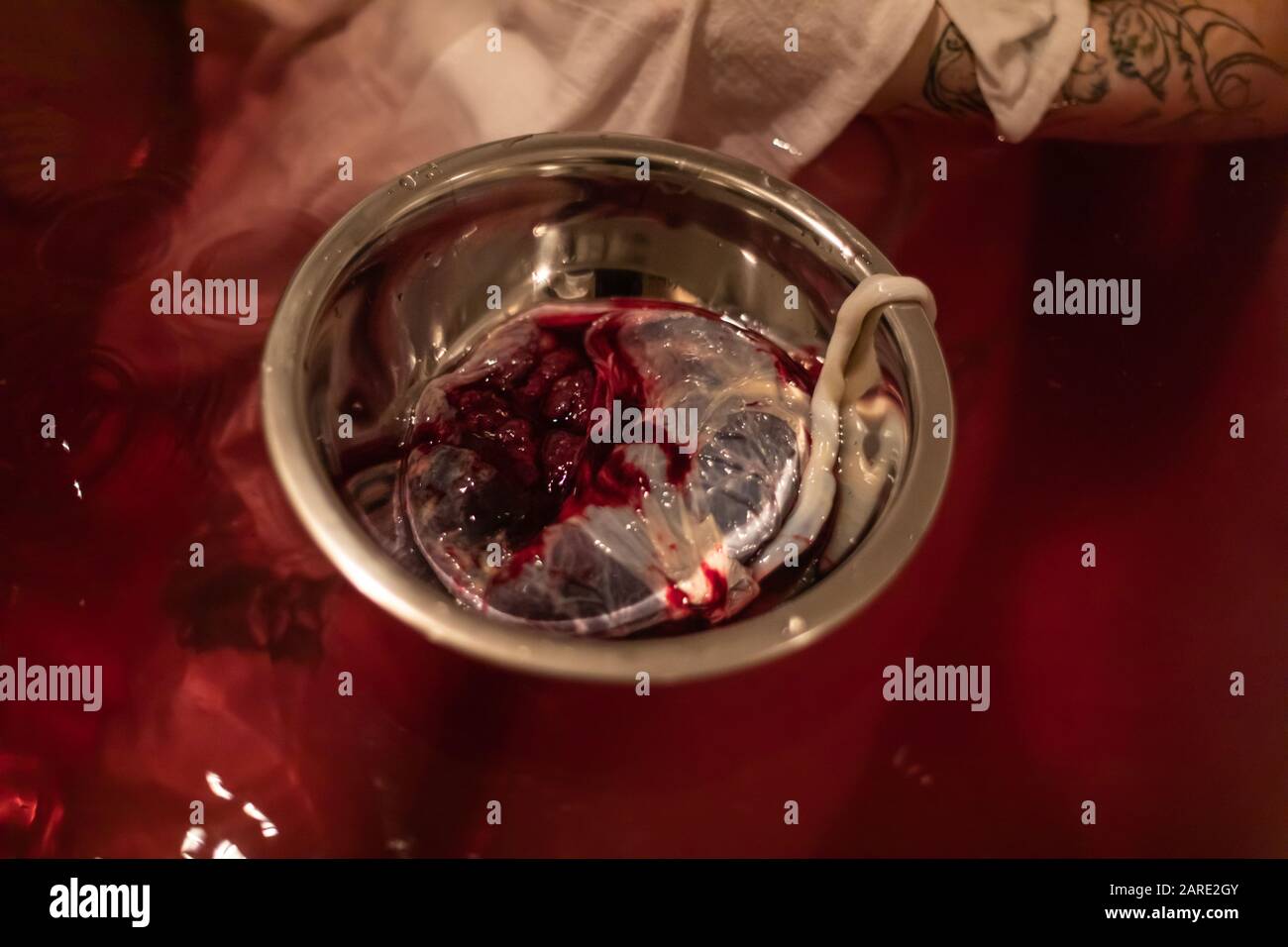 Placenta veins hi-res stock photography and images - Alamy