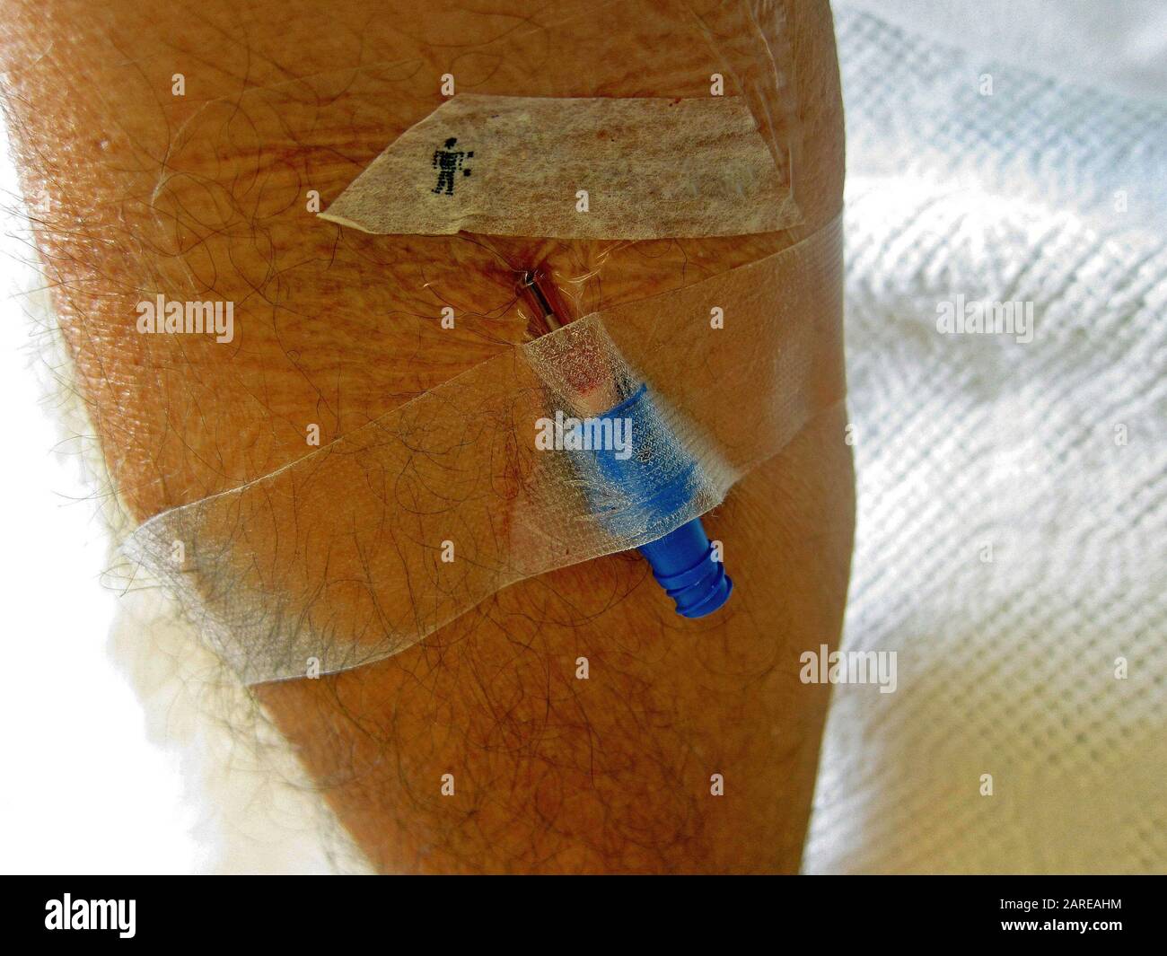 Dextrose injection hi-res stock photography and images - Alamy